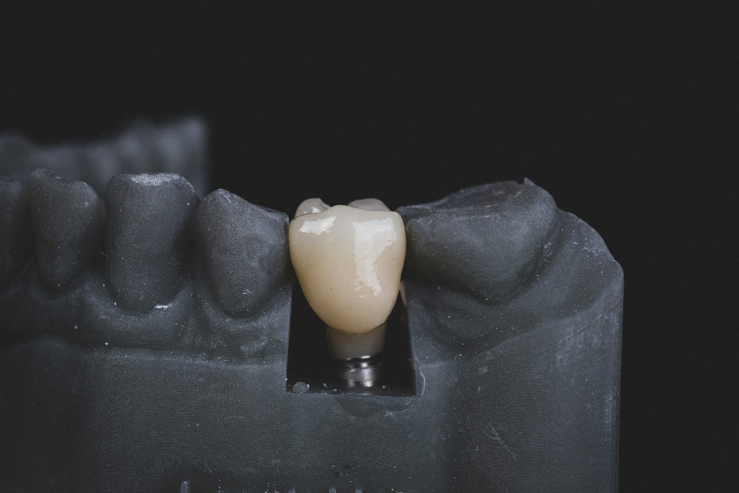Nitrous Oxide in Modern Dental Implant Procedures with James Kleiber ...